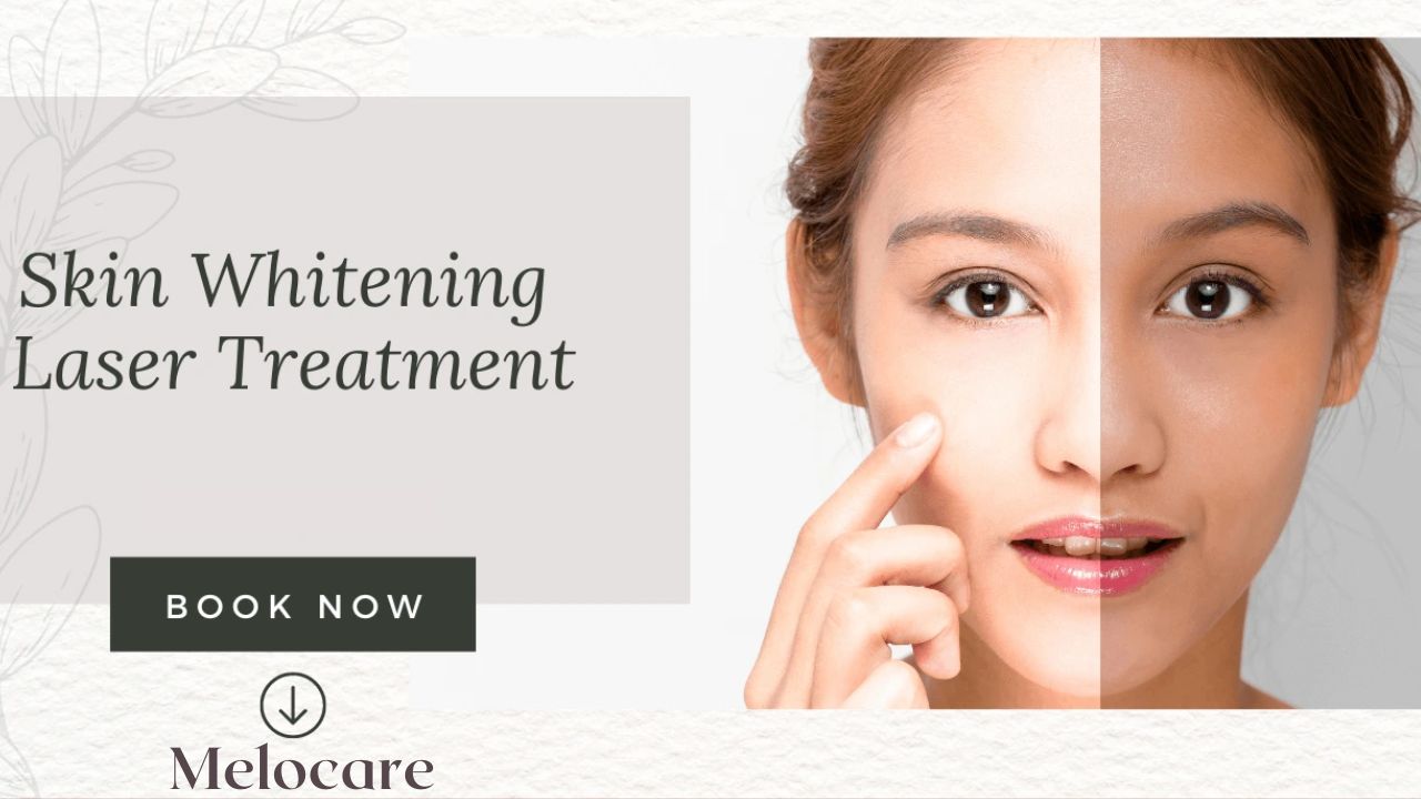 Laser Skin Clinic in Delhi - Melocare
